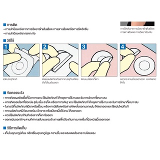 Hemostatic Patch After Injection Pad Nichiban (100pcs/Box) | Shopee ...