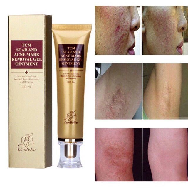 Labena scar gel ubat parut luka, jerawat, bekas bedah Original | Shopee ...