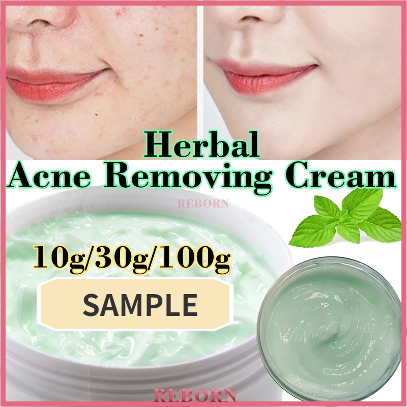 REBORN Hebal Acne Cream Moisturizing Hydrating Natural Whitening 10g ...