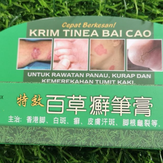 Ready stock! Krim tinea bai cao untuk rawatan rekahan tumit kaki panau ...
