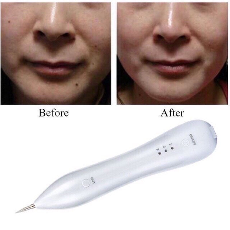 Beauty Spot Pen mesin penghilang tattoo kutil ketuat skin tag jeragat ...