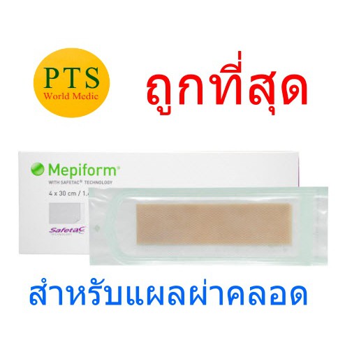Mepiform Silicone Gel Sheet 4x30 cm To Reduce Scars For Postpartum ...