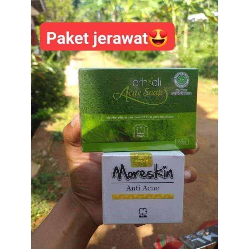 Nasa Original Acne Package (anti Acne Cream & Ershali Soap) | Shopee ...