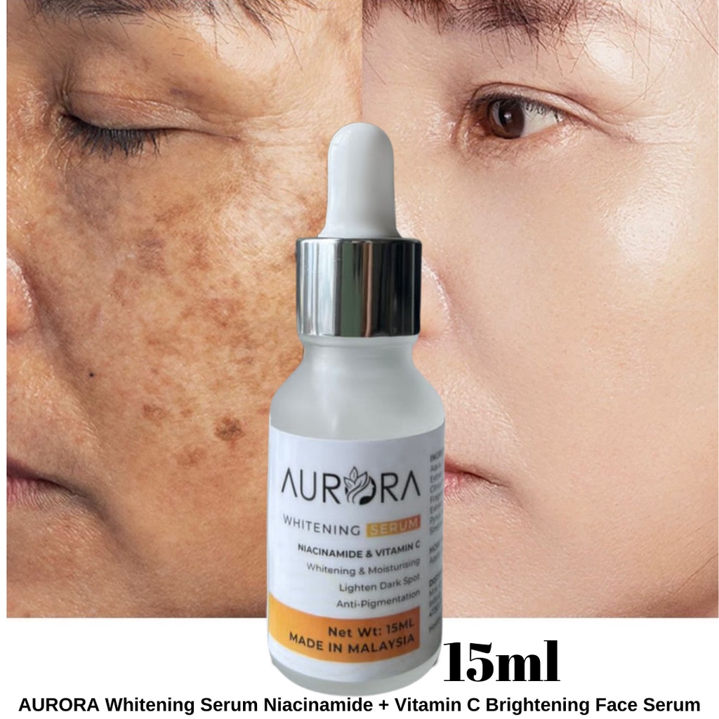 Whitening Serum Niacinamide + Vitamin C Brightening Face Serum Jeragat ...