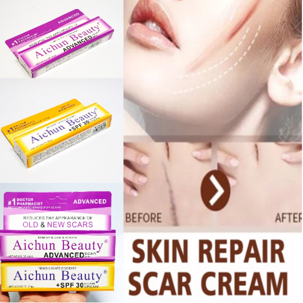 Scar Gel/ Scar Cream/ Parut Jerawat/ Stretchmark/ Skin Repair ...