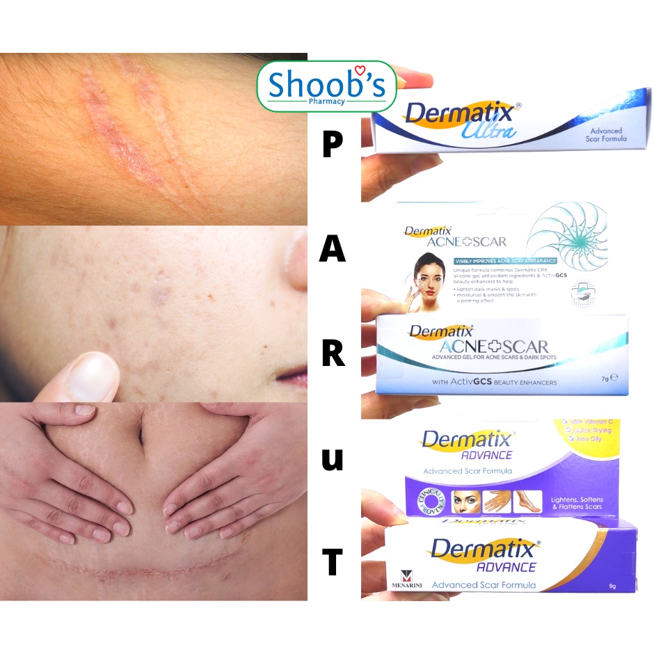 DERMATIX/Ubat Parut/Krim Parut Jerawat/Dermatix Ultra Gel 15G/Dermatix ...