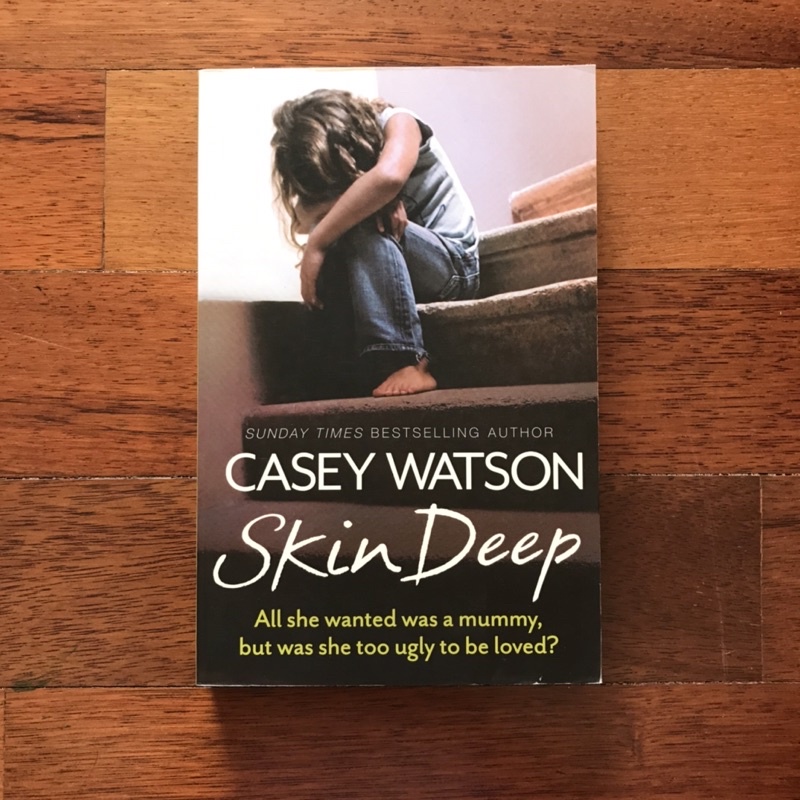 SKIN DEEP | Casey Watson {NON-FICTION, FAMILY, FOSTERING} | Shopee Malaysia