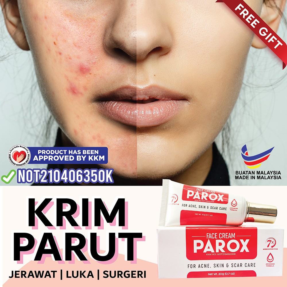 Scar Krim Parut Jerawat Scar Mask Skincare Kulit Mask Parut hitam, Krim ...