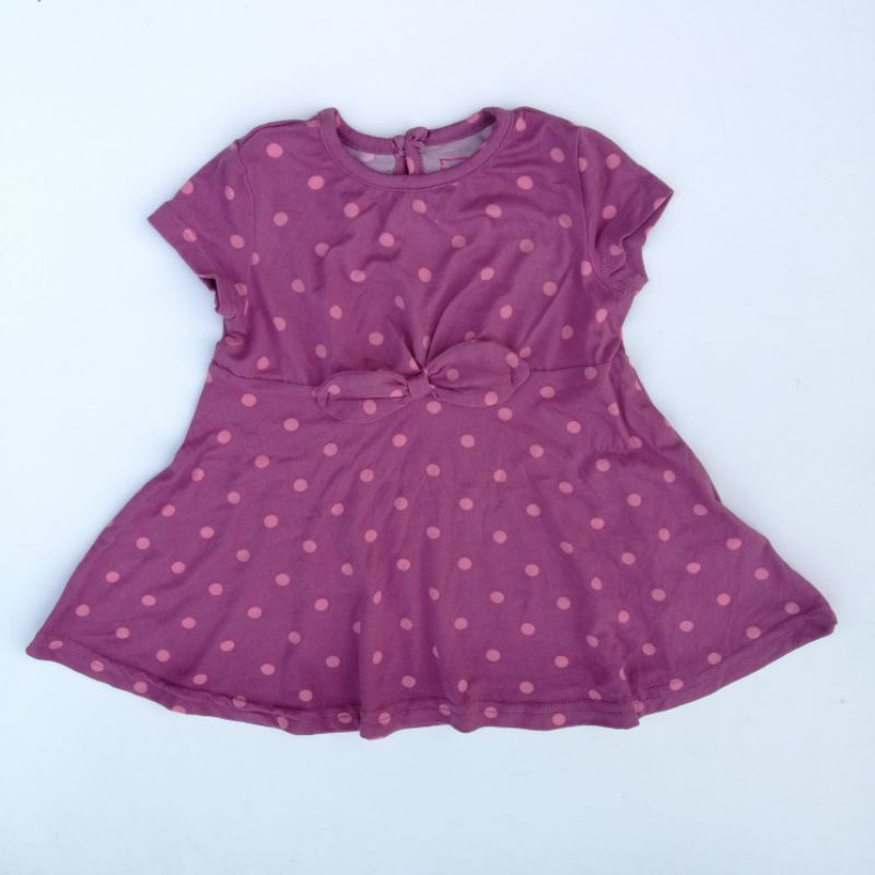 just lizzy baby girl dress(6-24m) | Shopee Malaysia