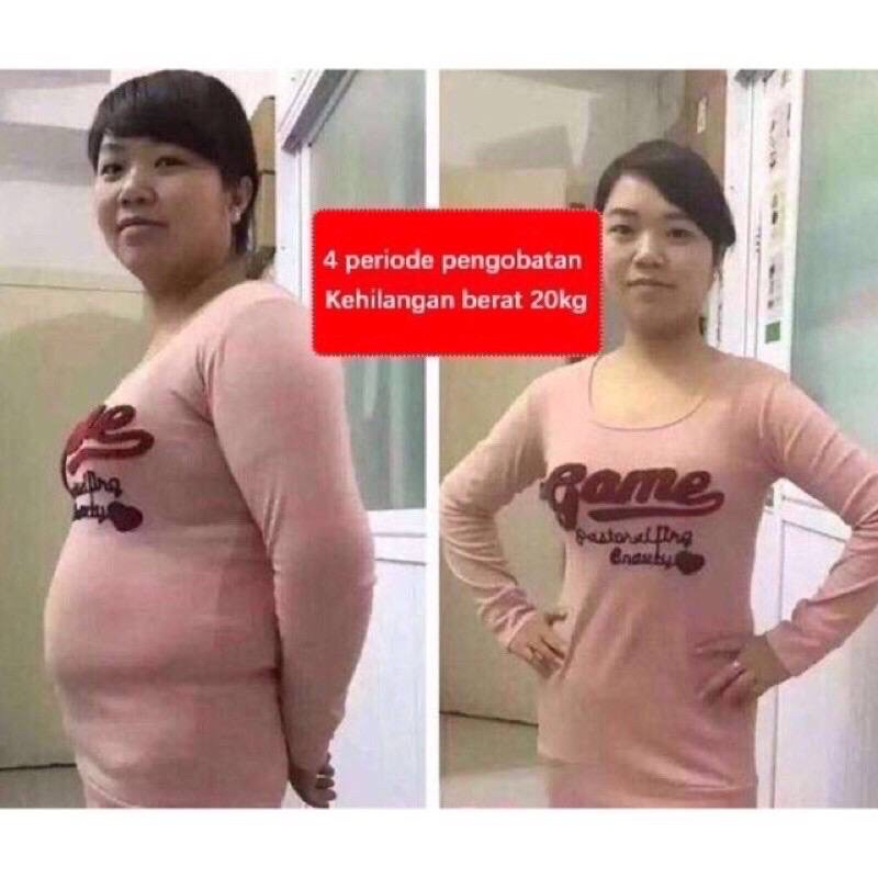 HERBA SLIMMING PATCH Buang lemak dengan cepat buang toksin badan ...