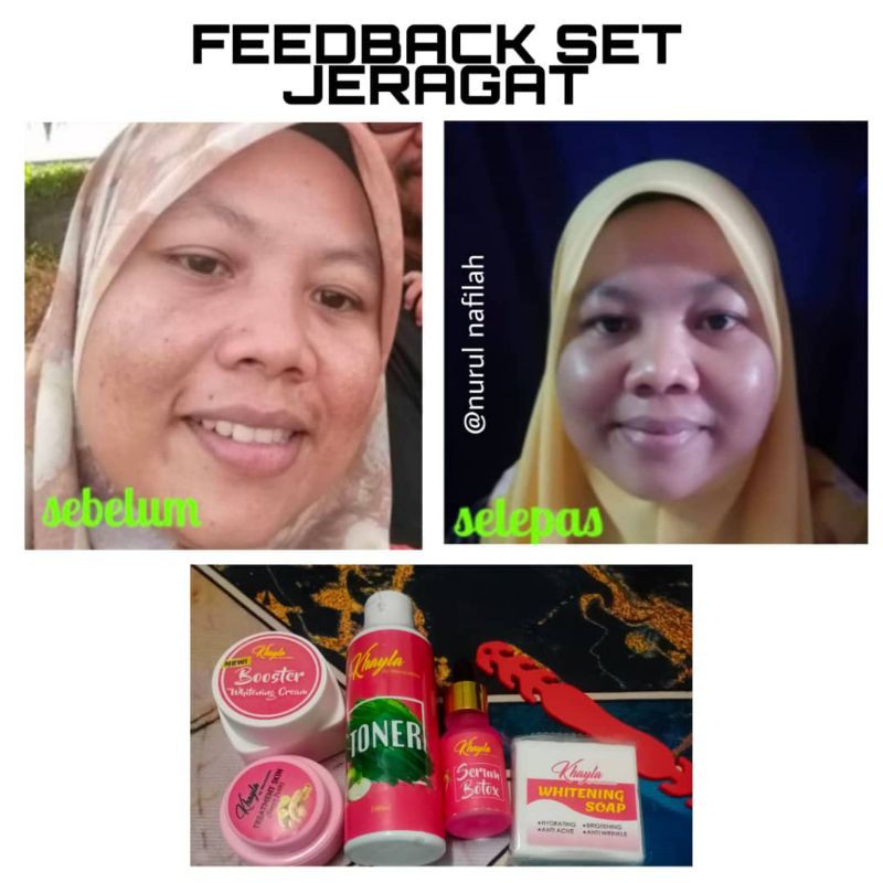 set jeragat khayla beauty | Shopee Malaysia