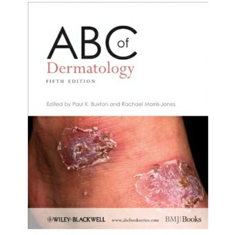 (Textbook) ABC of Dermatology | Shopee Malaysia