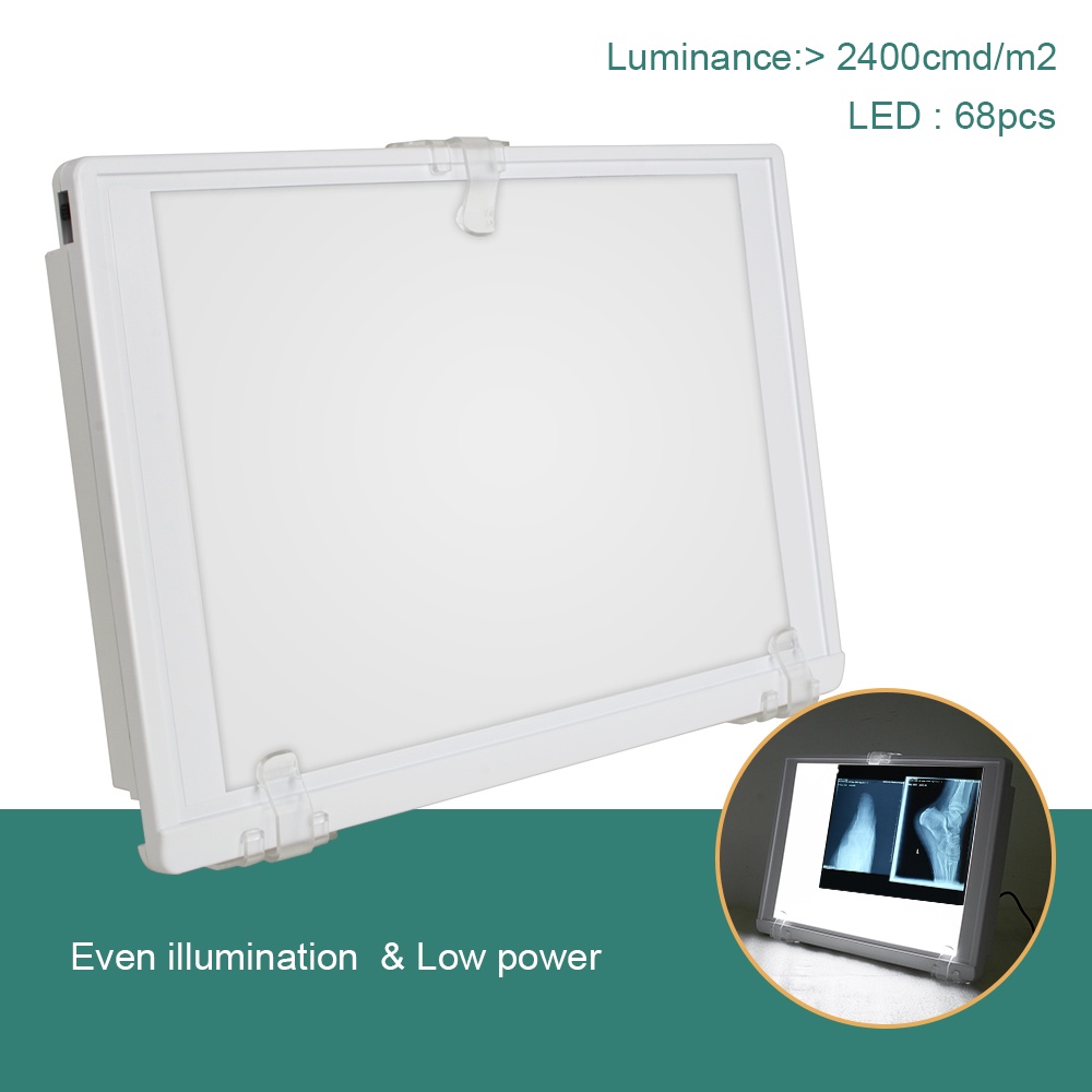 Dental Xray X ray Film Illuminator Light Box X-ray Viewer light Panel ...