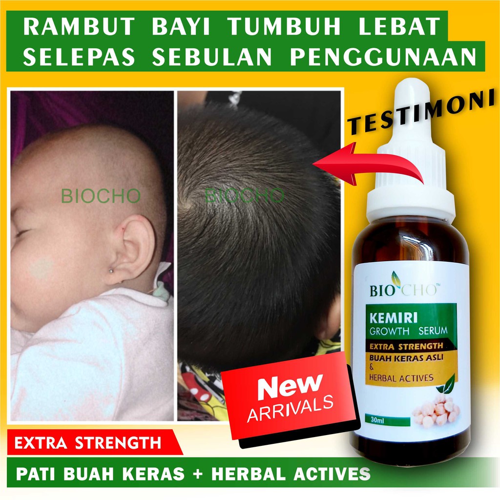 Minyak Rambut Baby, Serum Rambut Baby, Lebatkan rambut bayi, Pelebat ...