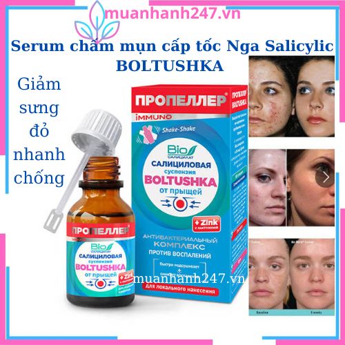 Essence for dark spots and acne, Russian Salicylic BOLTUSHKA Propeller instant acne Serum ...