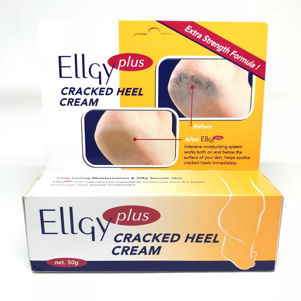 Ellgy Plus Cracked Heel Cream 50g | Shopee Malaysia