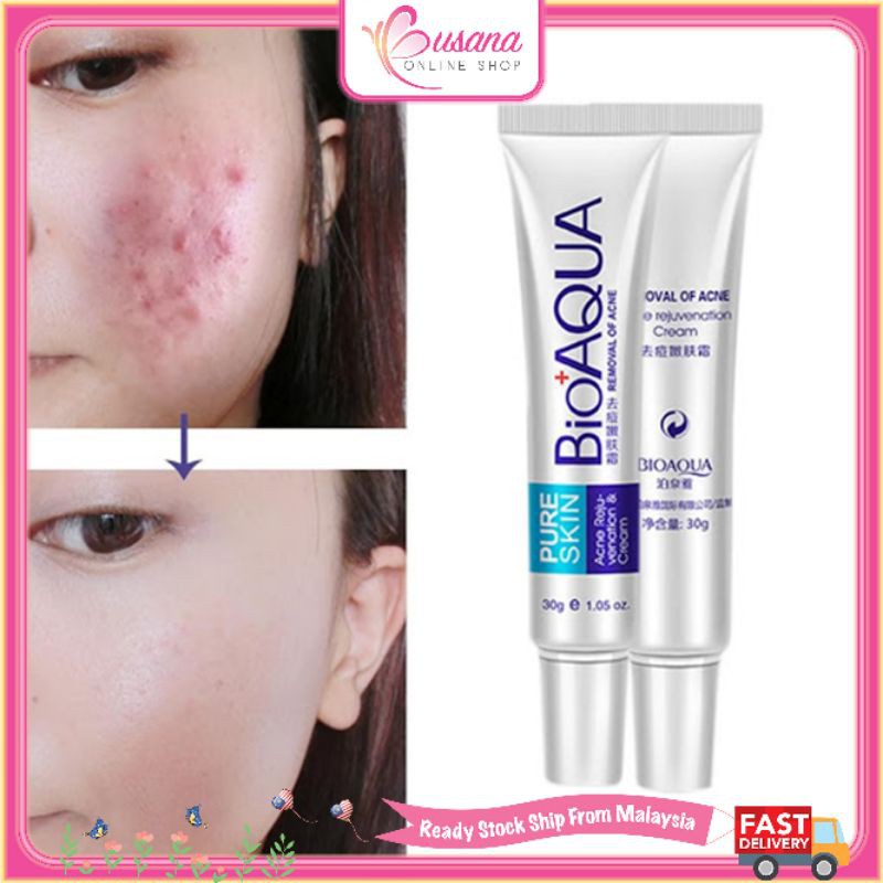 BIOAQUA Acne Rejuvenation Cream/ Acne Removal/ Whitening Moisturizing ...