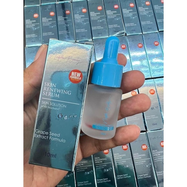 NB SERUM/NB CREAM/NB SOAP SCAR TREATMENT ‼️ORIGINAL💯💯 | Shopee Malaysia
