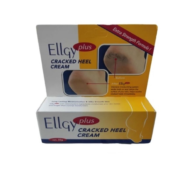 ELLGY PLUS Cracked Heal Cream 50g | Shopee Malaysia