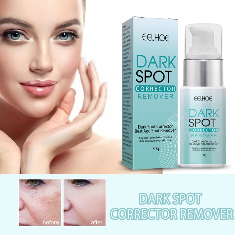 EELHOE Dark Spot Corrector Cream 30g Whitening Cream Spot Melasma Removal Dark Spot Remover ...