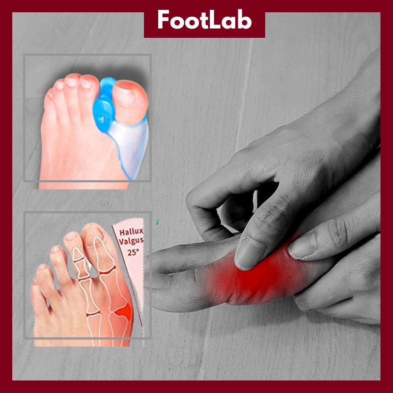 Bunion Corrector Thumb Hallux Valgus Toe Pembetulan Ibu Jari Kaki Toes ...