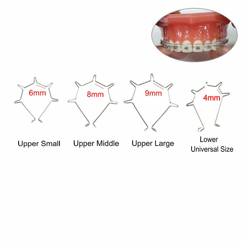 5pcs Dental Anterior Root Torquing Auxiliary Arch Teeth Torque Spring ...