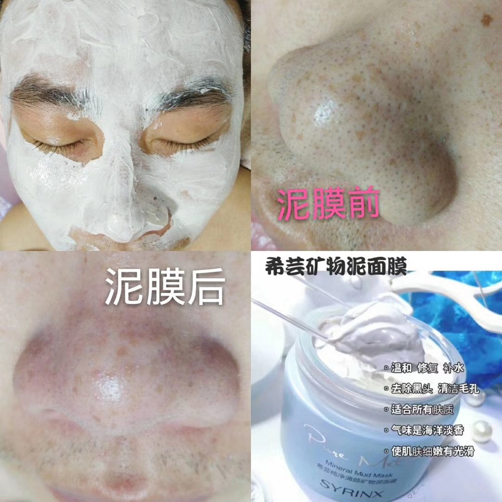 Syrinx Mineral Mud Mask, 135g Remove Black Head, White Head, Pore ...