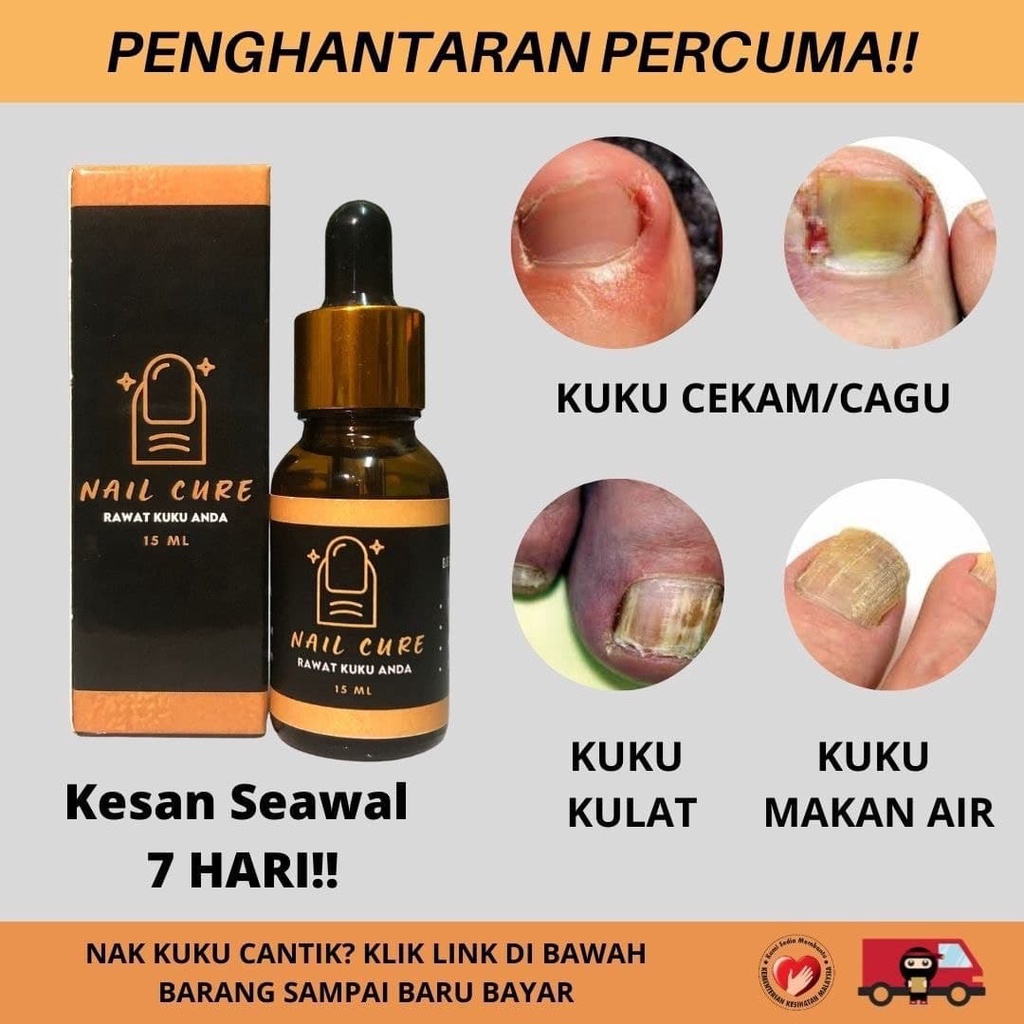 freeshipping Nail Cure ORIGINAL /cekam/reput/cagu/hitam/kulat (ready ...