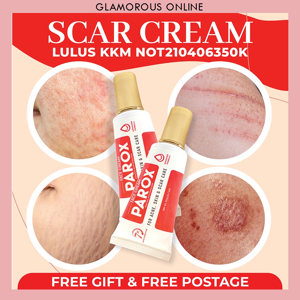 colourpop Cream Parox Krim Parut Krim Klinik Ice pick Deep Scar Cream ...