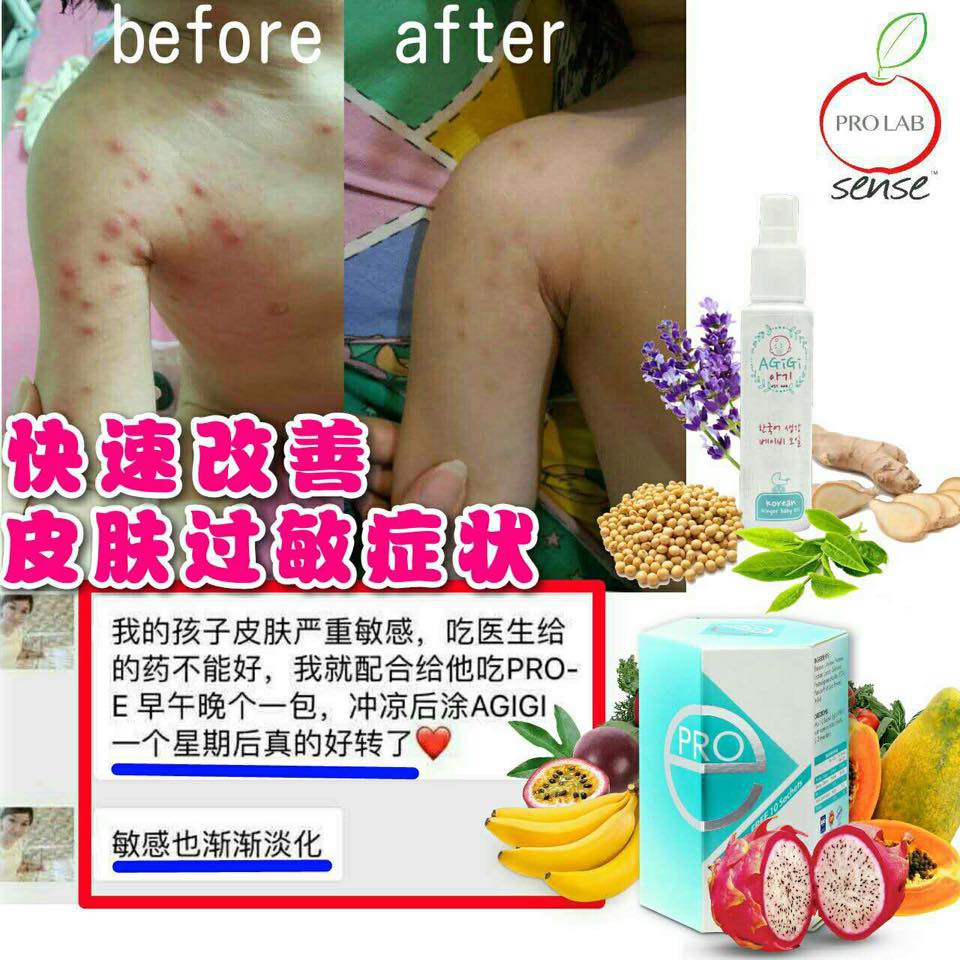 PROe Enzyme 15 sachets 生命酵素 (Pro Lab Sense) | Shopee Malaysia