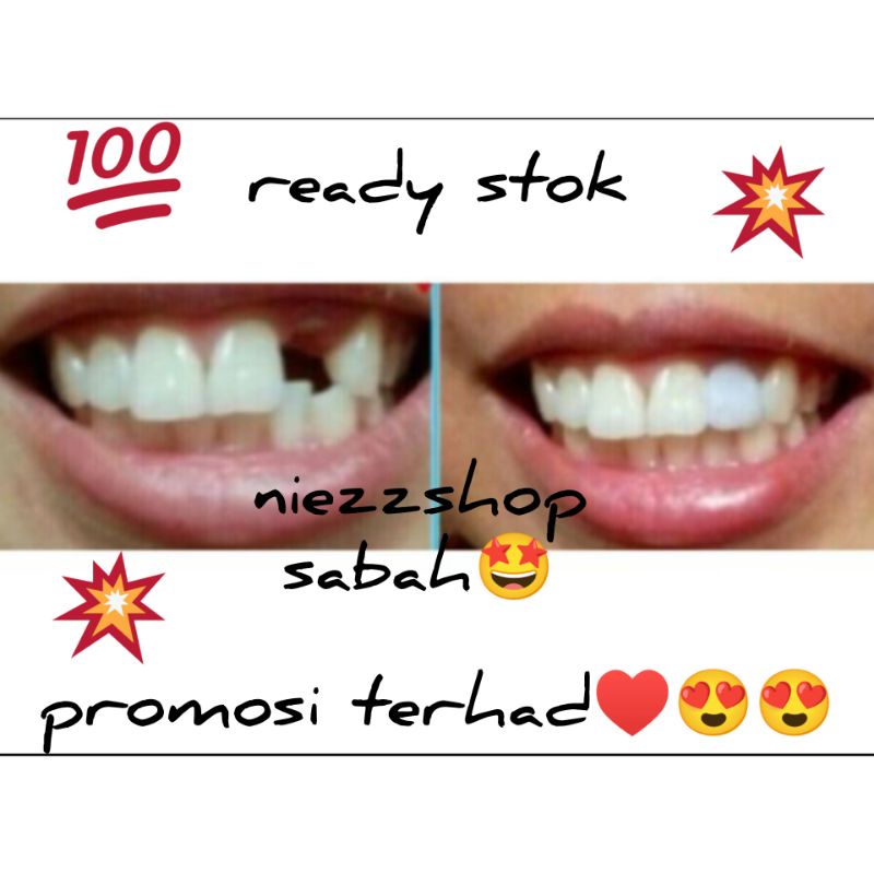 ready stok promosi temporary teeth, gigi palsu, instant tempt tooth ...