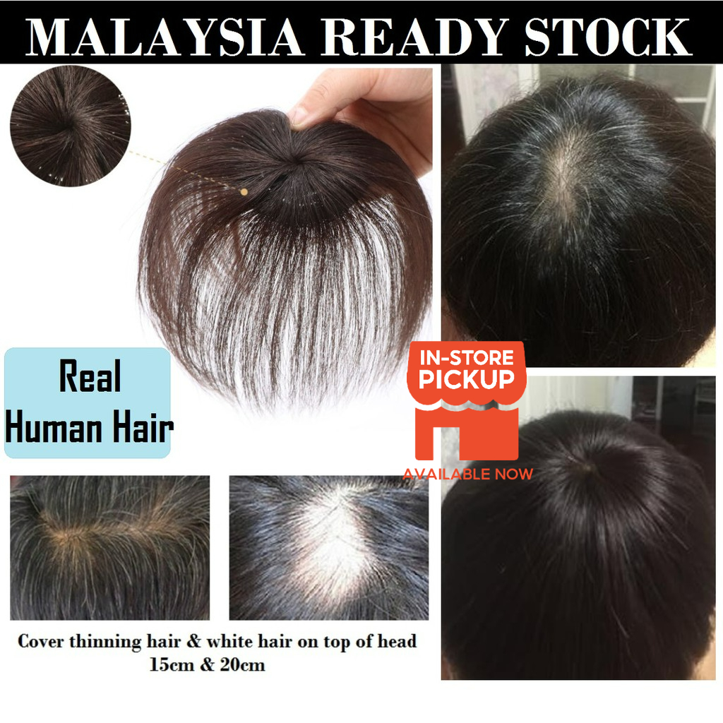 Rambut Palsu Manusia Penebal & Tutup Uban Real Human Hair 15 & 20cm Wig ...