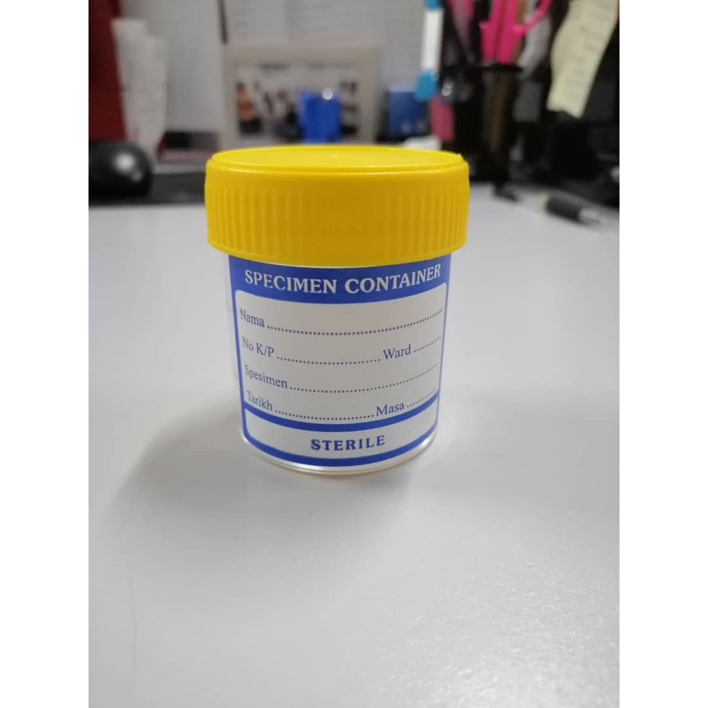PS Urine Container (Sterile) 60ml with yellow cap & label | Shopee Malaysia
