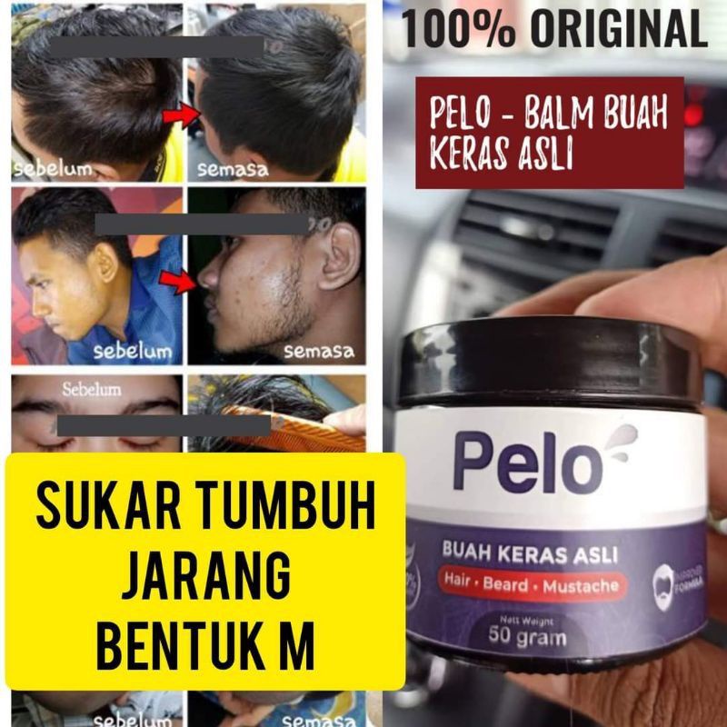 FAST POSTAGE!!! PELEBAT RAMBUT PELO BALM BUAH KERAS FREE POS/GIFT 100% ...
