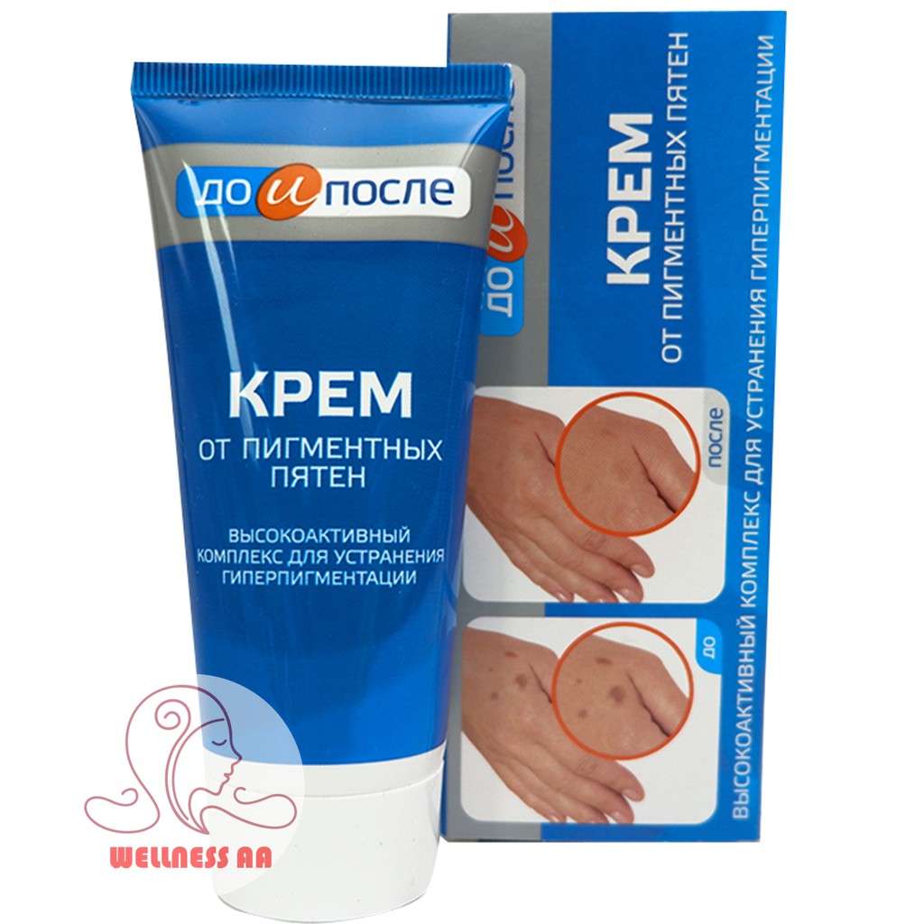 KPEM Hand Cream treat Melasma, Dark Sports Age Spots and Brown Spots ...