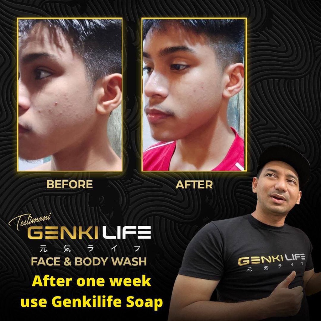 ZIZAN GENKI LIFE Sabun GENKILIFE Soap Merawat Kulit Muka Badan Daki ...