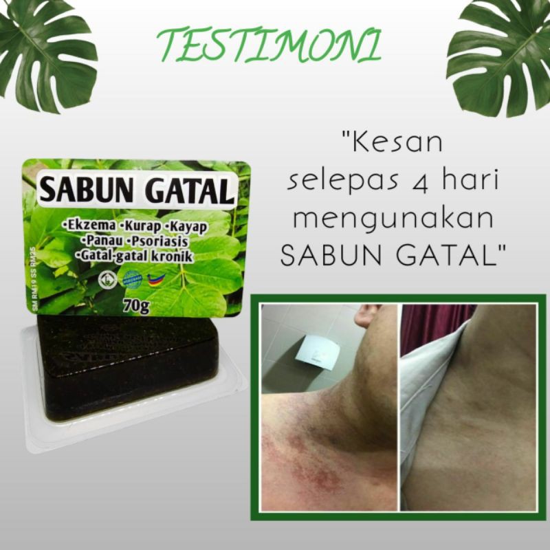 [FAST SHIPPING]Sabun gatal Sabun ekzema organik tanpa SLS Soap organik ...