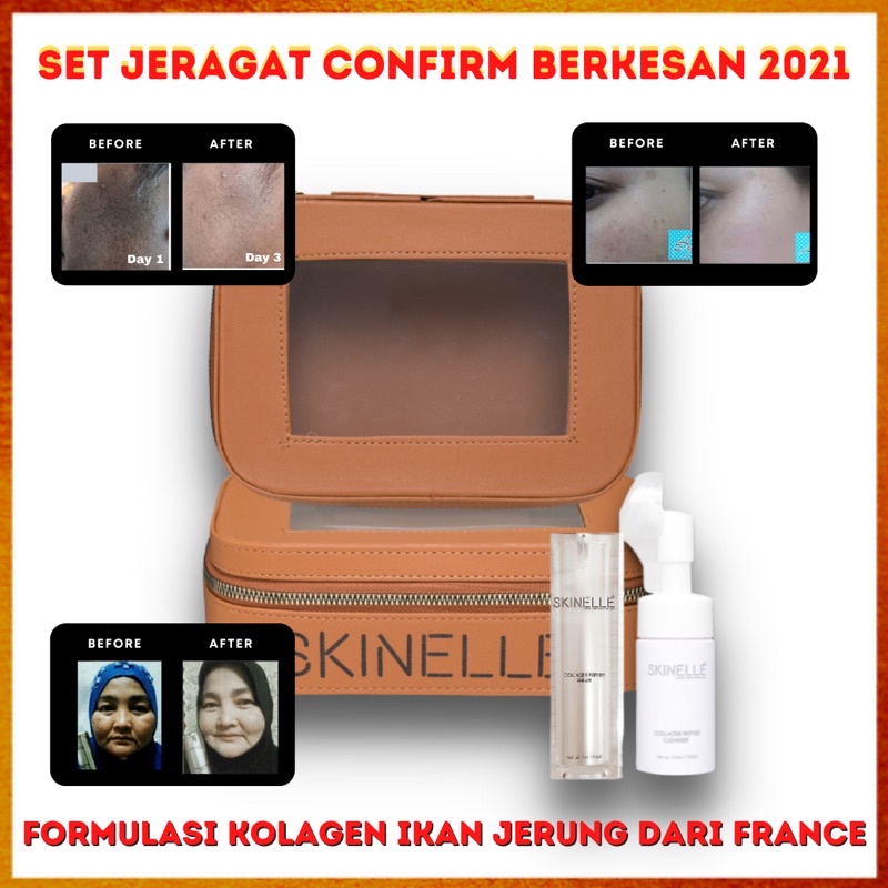 SKINELLE Skincare Jeragat Paling Berkesan 2022 | Shopee Malaysia