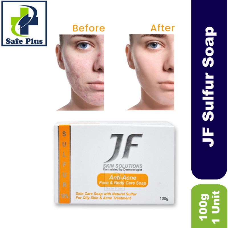 JF Sulfur Soap Sabun Sulphur Anti Acne Pencuci Muka | Shopee Malaysia