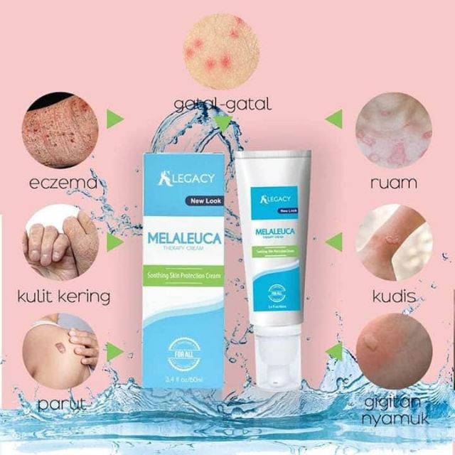 (Ready stock) Cream melaleuca-kudis-ruam-gatal-eczema-kurap boleh ...