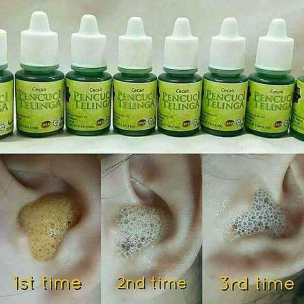 Original Ear Wax Cleanser | Ubat Sakit Telinga As Syifa | Shopee Malaysia