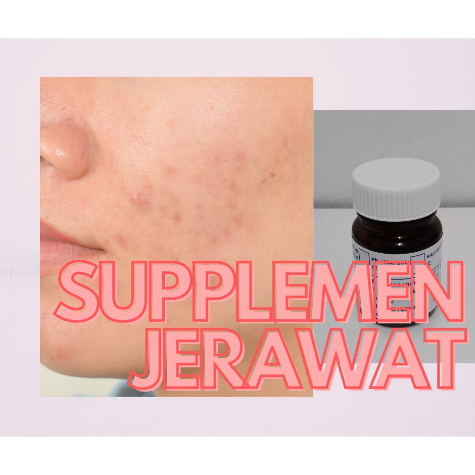 SUPPLEMEN UNTUK JERAWAT DEGIL | ACNE | MUKA MINYAK & MERAH | PORES ...