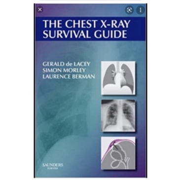 The Chest X-Ray: A Survival Guide Medical Books Radiology The Chest ...