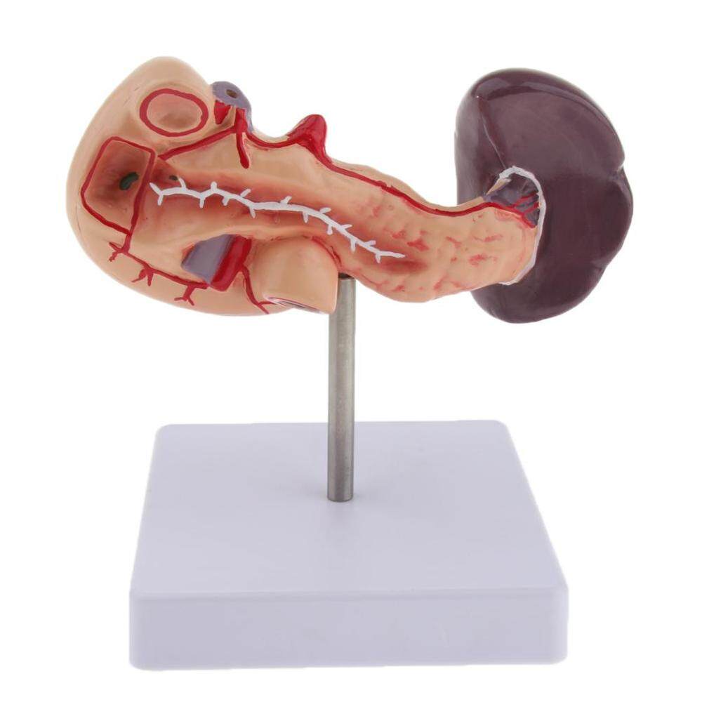 Human Pancreas Duodenum Spleen Anatomical Model / Pancreas Spleen ...