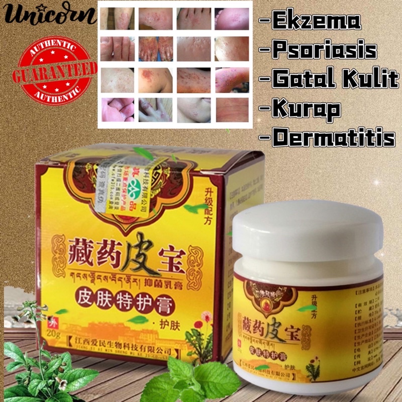 Ready Stock 藏药皮宝 特效升级版 Eczema treatment Anti bacterial skin fungus ...