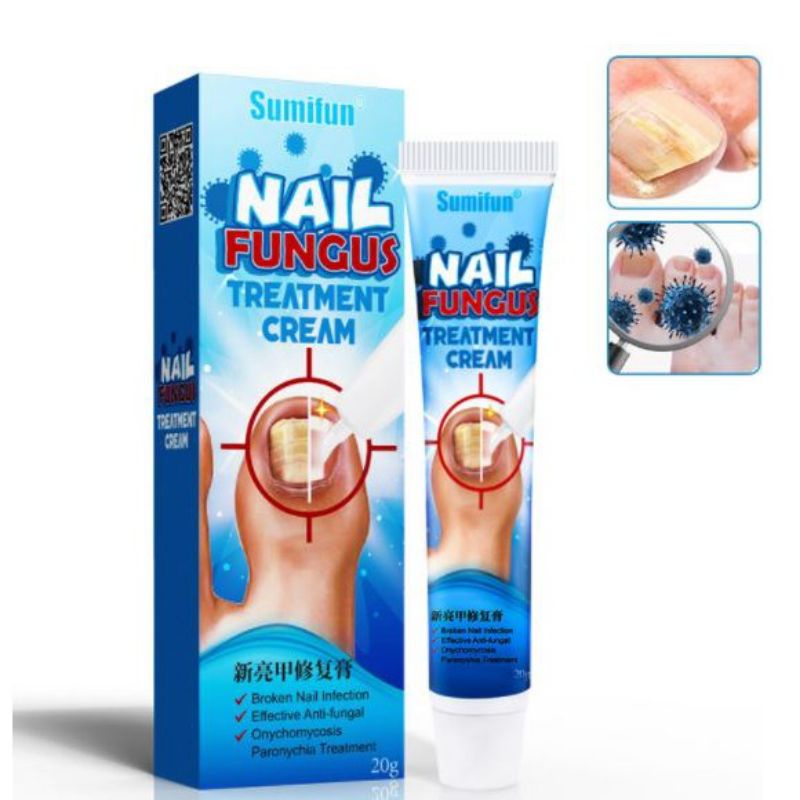 NAIL FUNGUS TREATMENT CREAM VIRAL VIRAL CREAM MASALAH KUKU 20G | Shopee ...