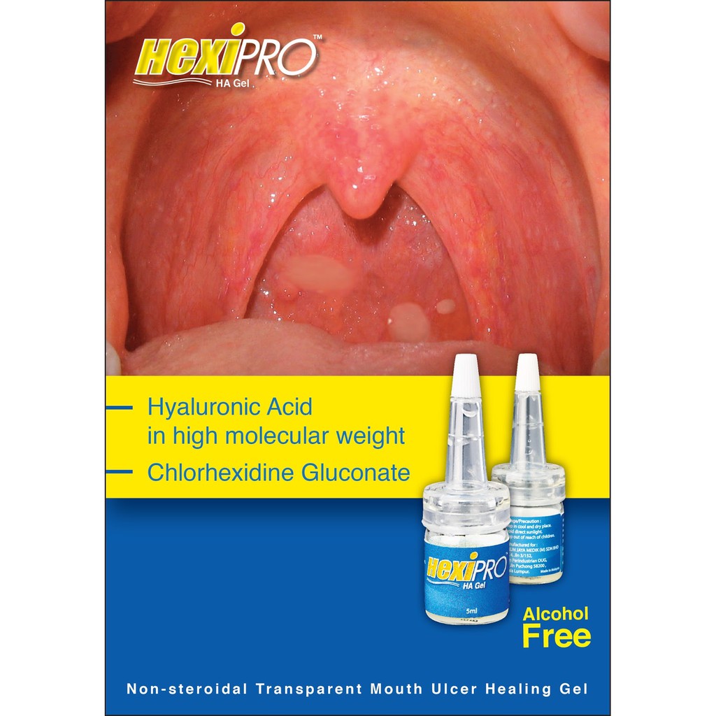 HexiPRO HA Gel - Hyaluronic acid for ulcer 5ml (EXP 7/2022) | Shopee ...