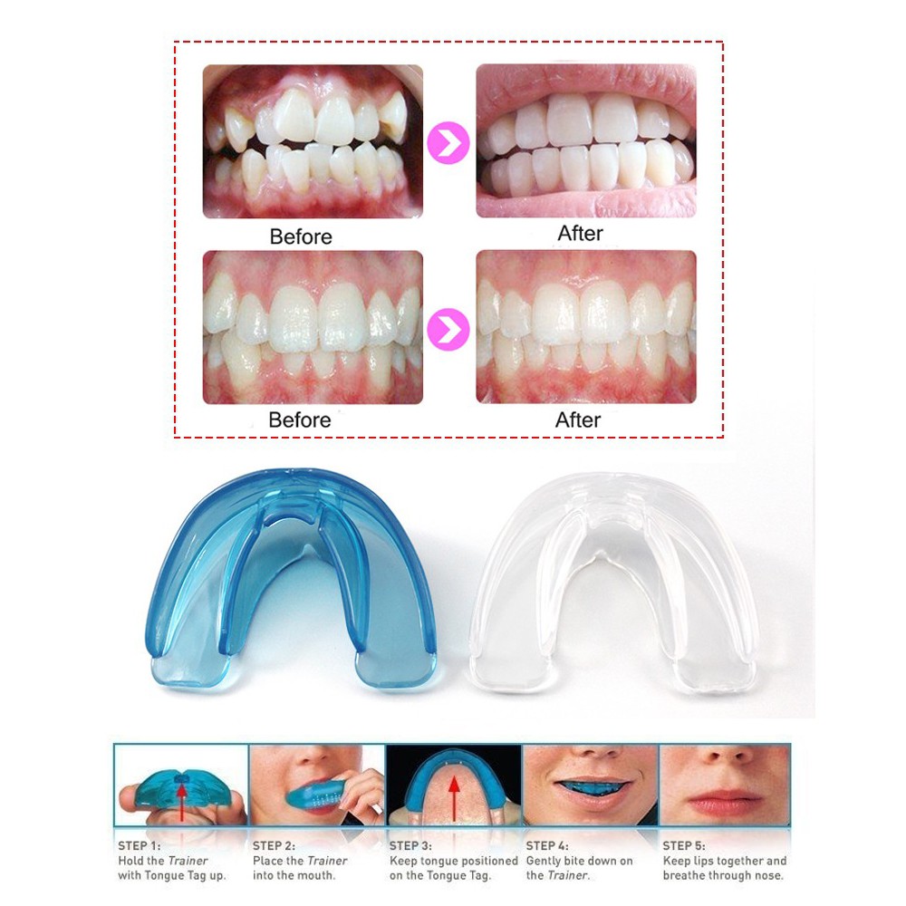 TRAINER Dental Oral Alignment Teeth Trainer Appliance Adult Orthodontic ...