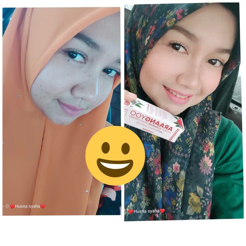 araang yoo produk elyss | Shopee Malaysia