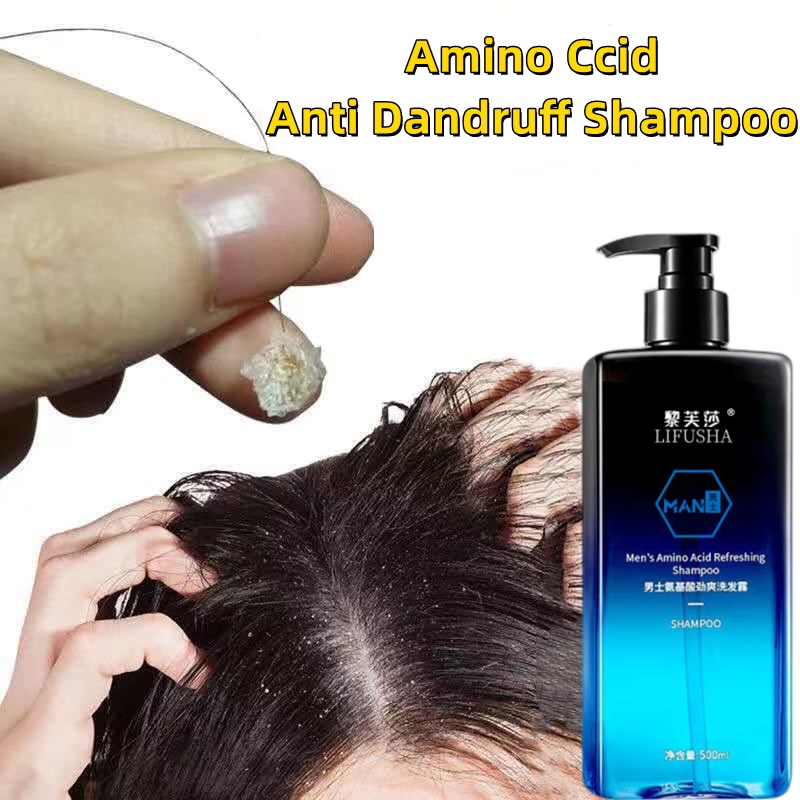 shampoo kelemumur anti dandruff shampoo amino acid dandruff shampoo ubat kelemumur kepala oil ...